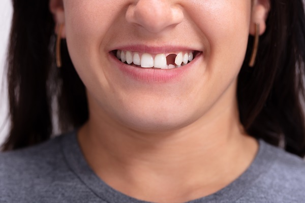 Reasons To Replace A Missing Tooth Visalia Care Dental Visalia California